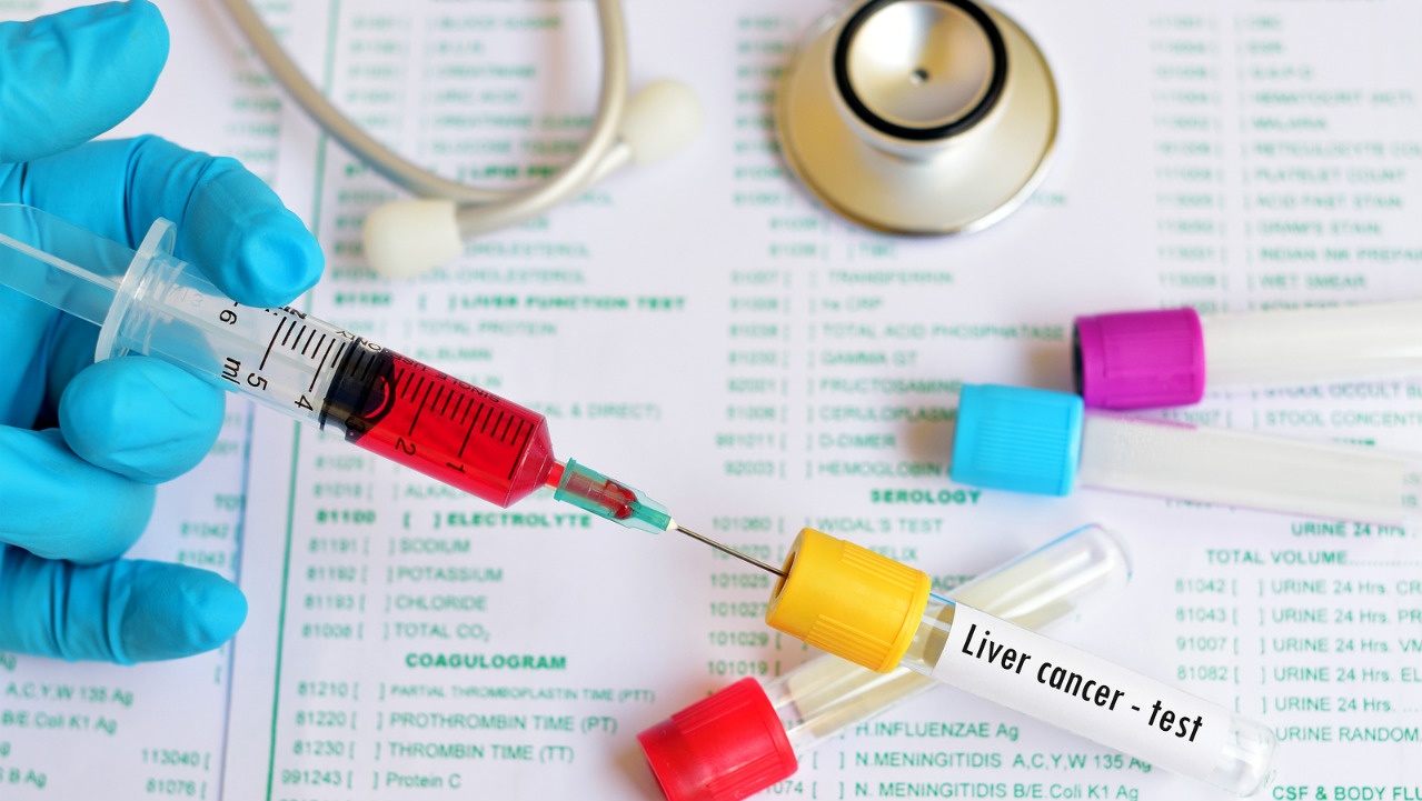 Descubre cómo afecta el consumo de alcohol en la aparición del cáncer