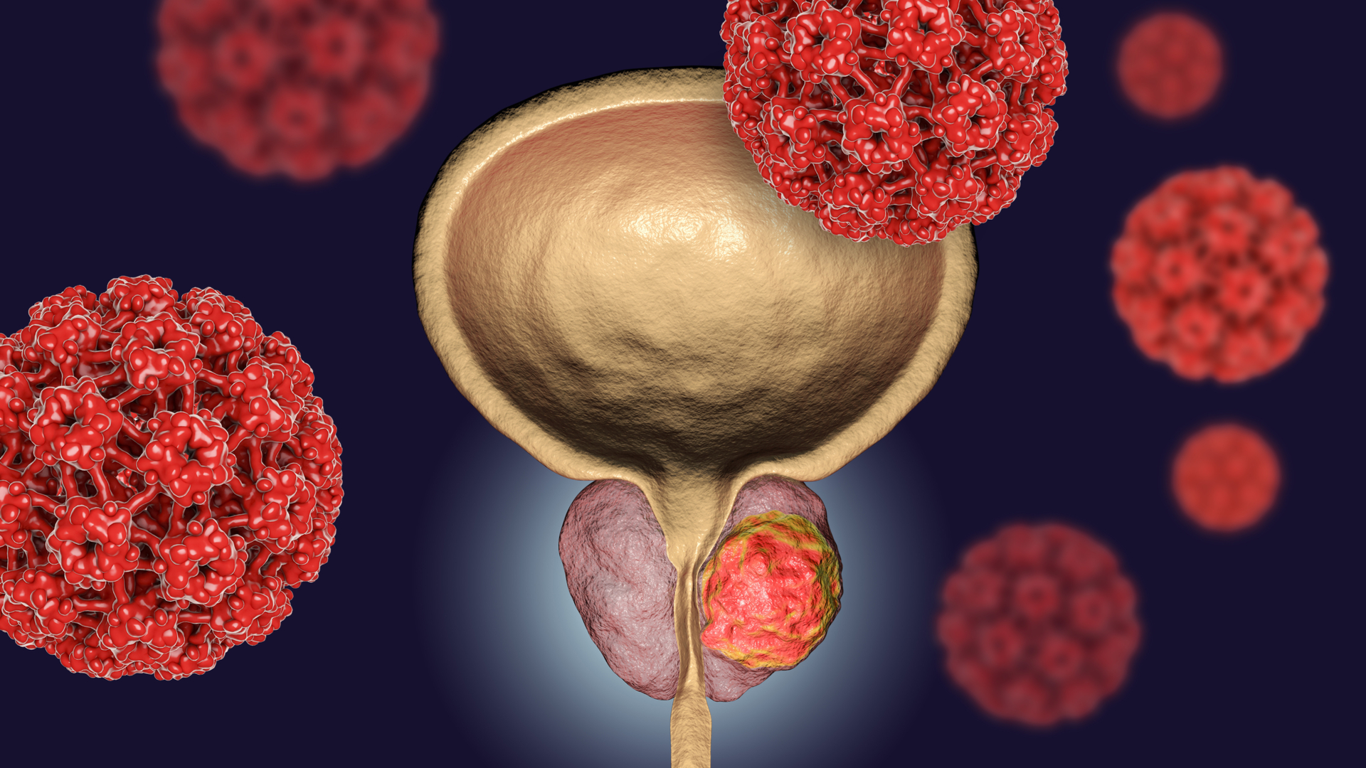 ¿Por qué es importante el examen de tacto rectal?