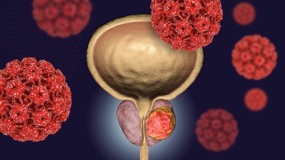 ¿Por qué es importante el examen de tacto rectal?