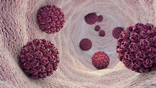 VPH en Lengua y Garganta: Causas, Síntomas y Tratamiento