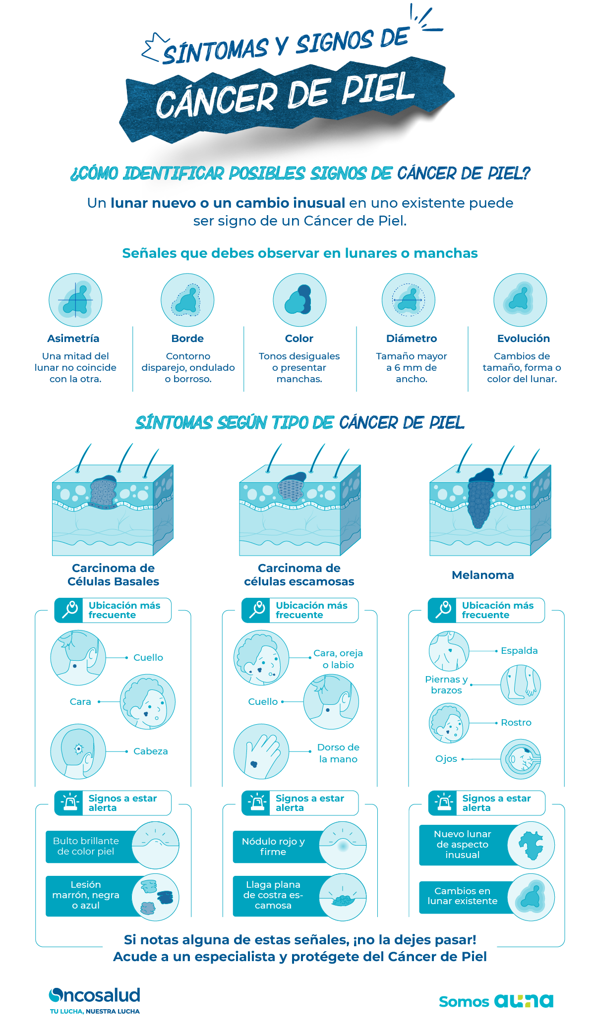 Cáncer de piel avanzado: síntomas y tratamiento